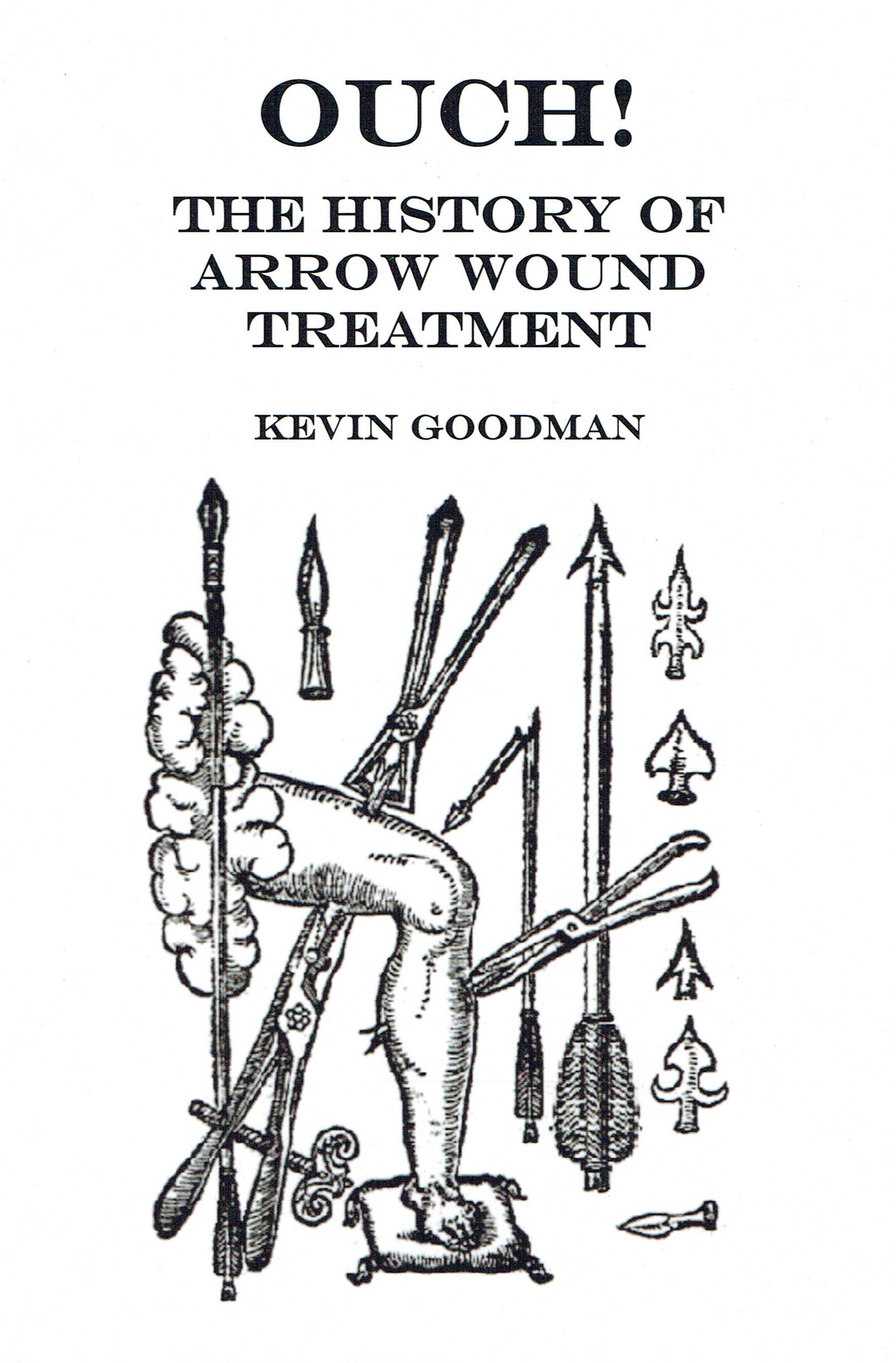 OUCH! THE HISTORY OF ARROW WOUND TREATMENT (SIGNED COPY)